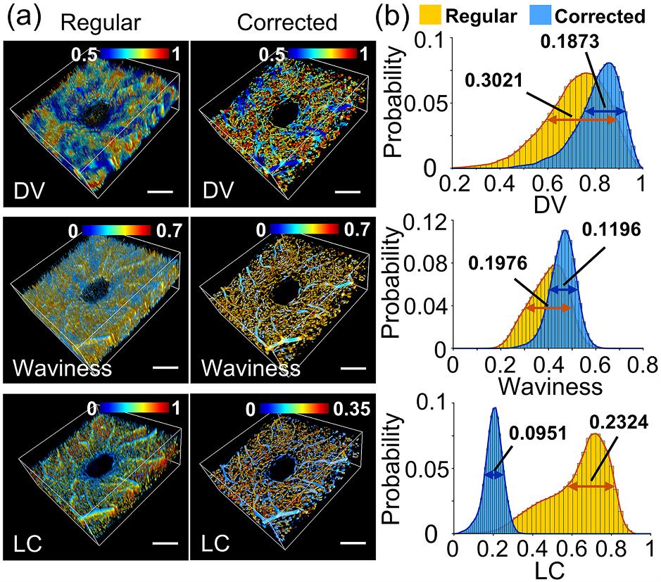 Morphology-constrained suppression of axial artifacts enhances 3D OCTA ...